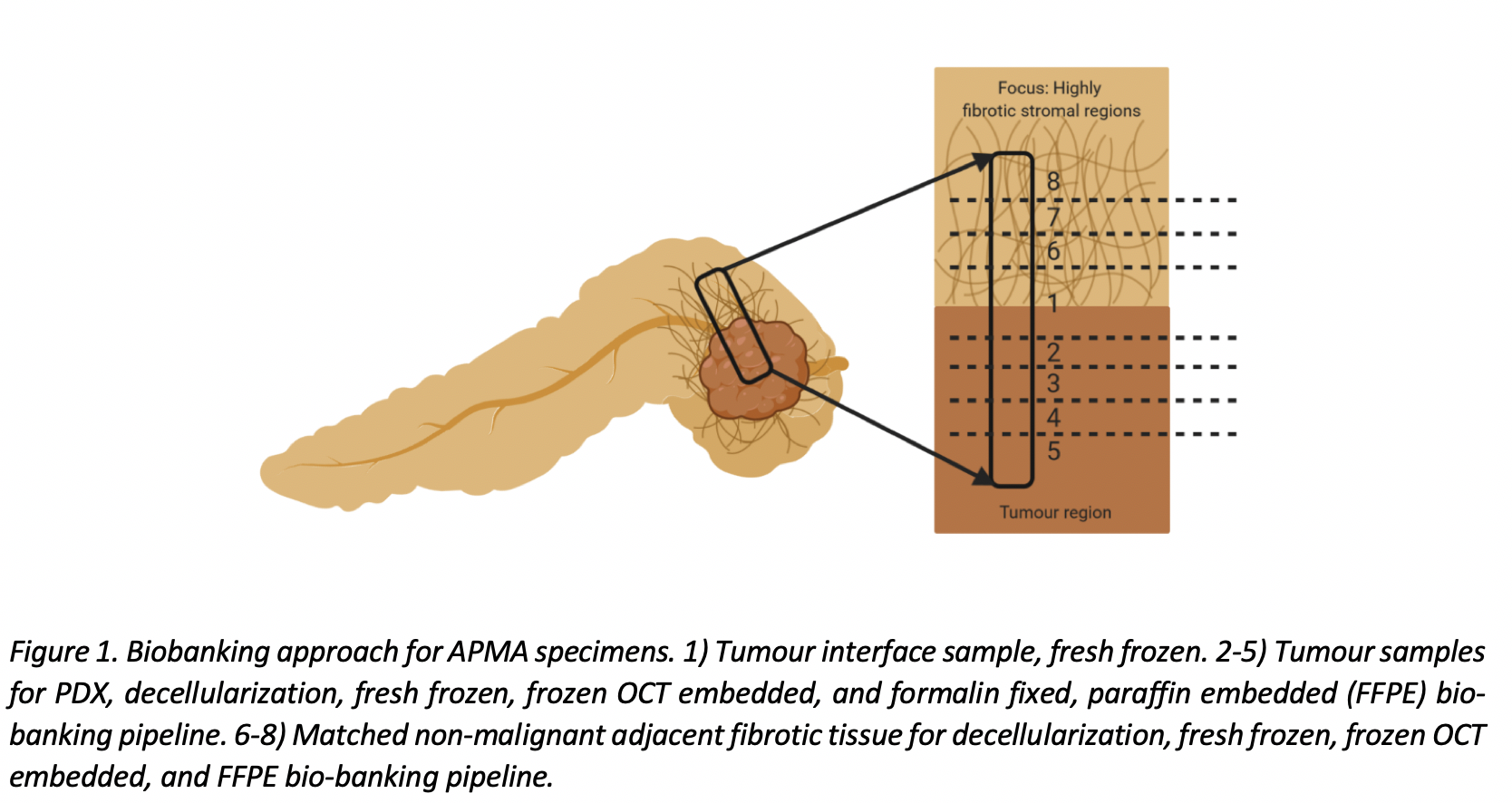APMA | Australian Pancreatic Cancer Genome Initiative