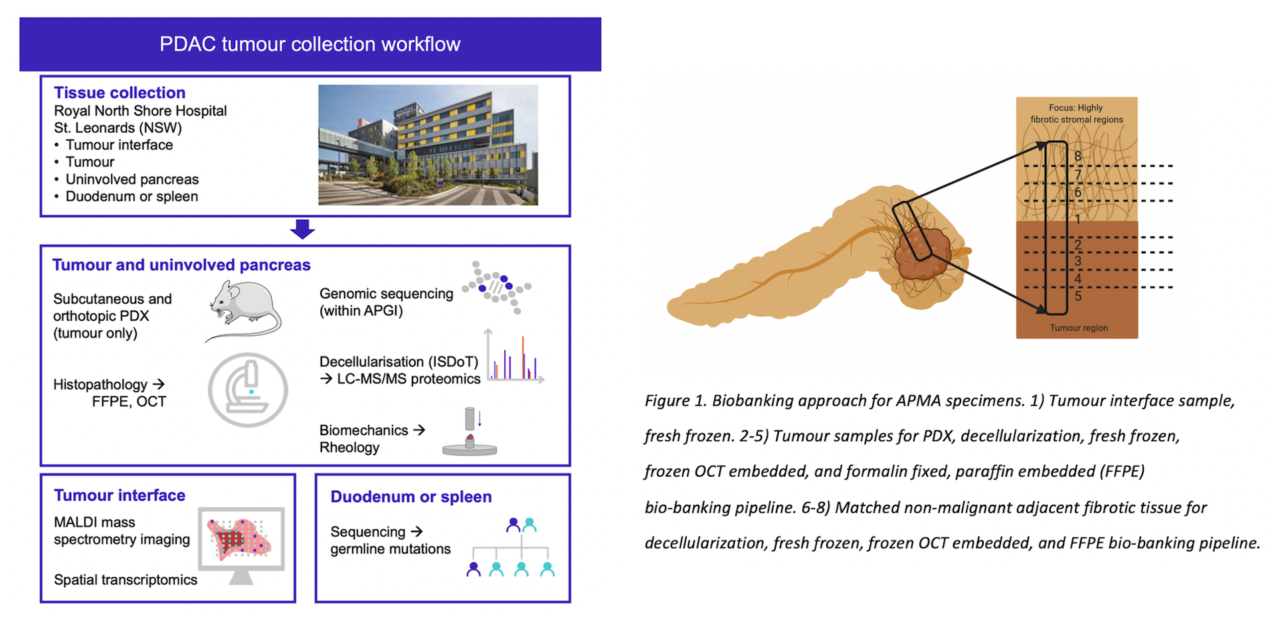 APMA | Australian Pancreatic Cancer Genome Initiative